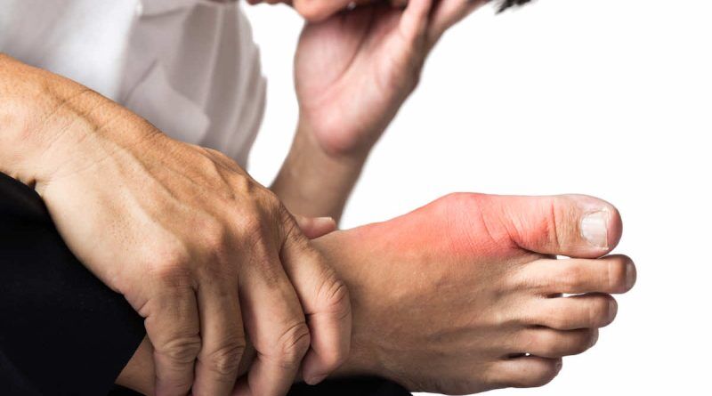 Foot Pain Location Chart and the Causes of Foot Pain - Complete Joint Care