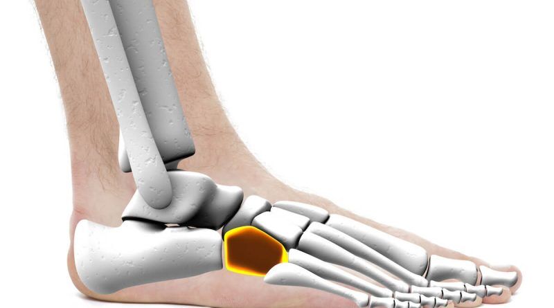 Easing Cuboid Bone Pain: Simple Steps and Exercises for Relief ...